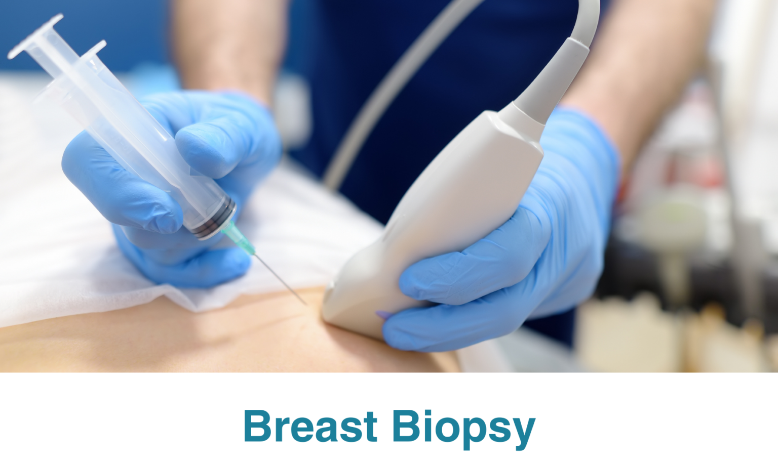 What is a Breast Biopsy? - Proton Therapy