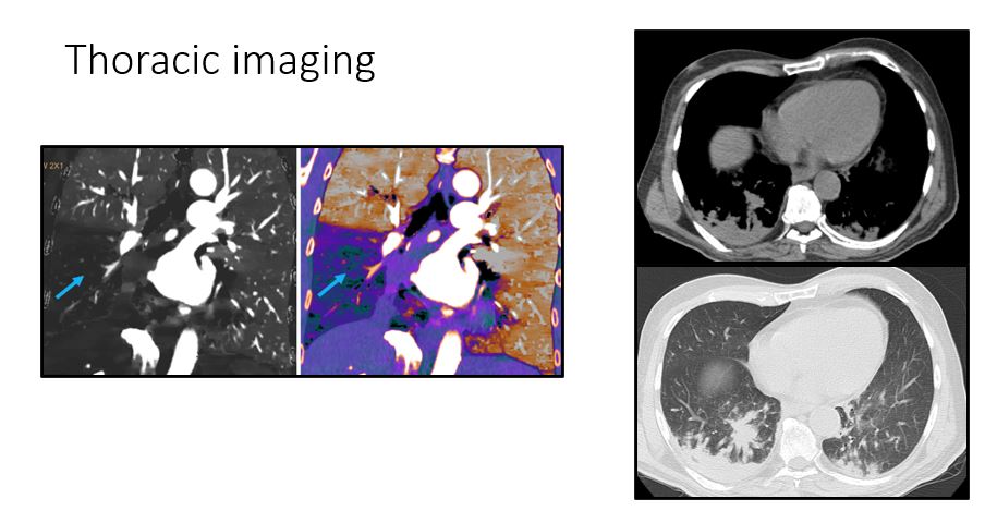 Radiology Treatment - Apollo Hospital Bangalore