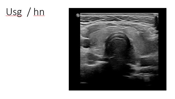 Radiology Treatment - Apollo Hospital Bangalore