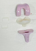 Ceramic Total Knee Replacement (Ceramic TKR) - Apollo Hospitals